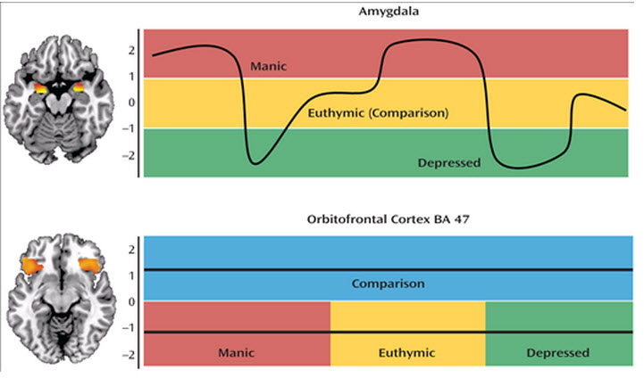 Bipolar Brains - MoodSurfing
